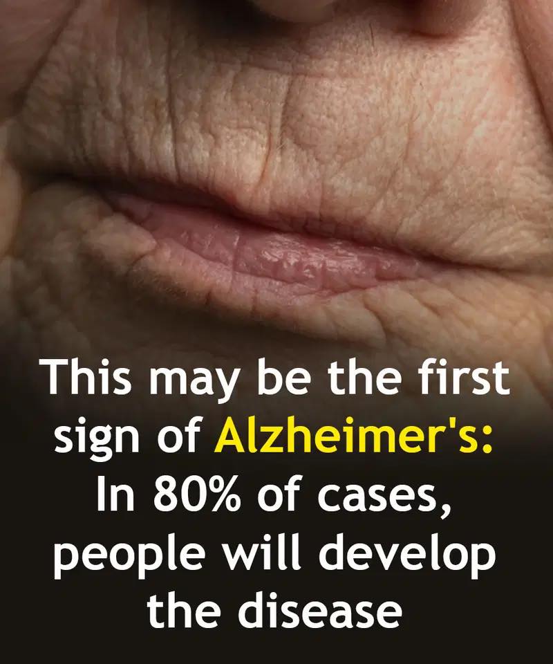 This may be the first sign of Alzheimer’s: In 80% of cases, people will ...